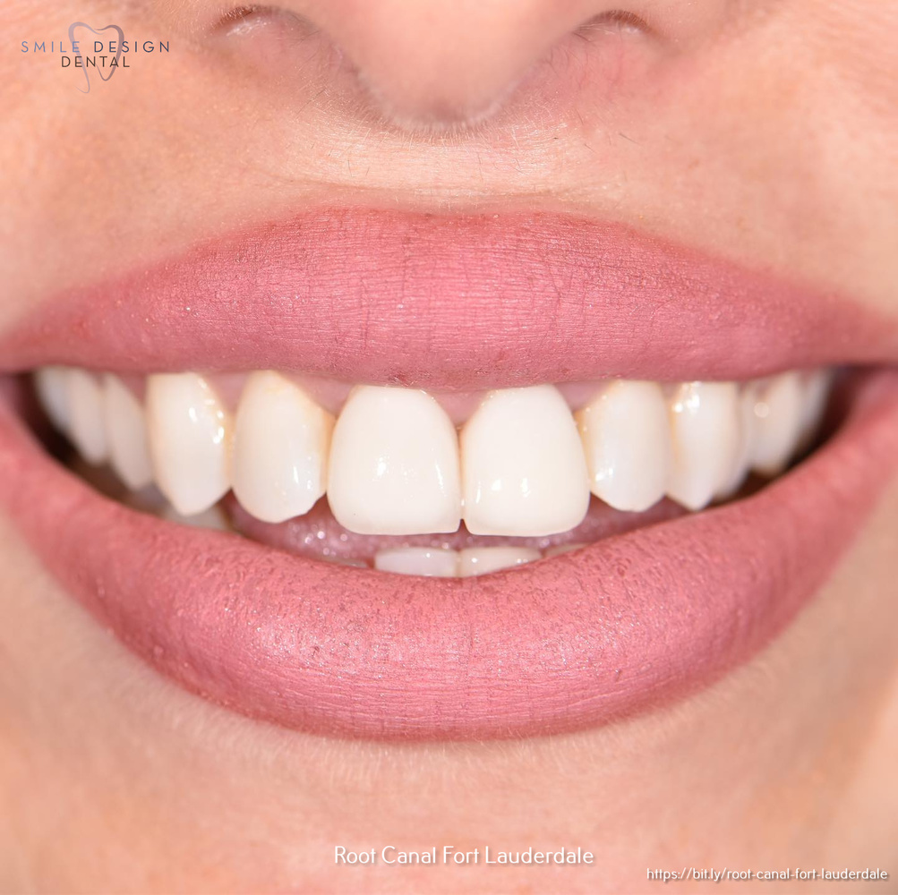 Orthodontist Fort Lauderdale